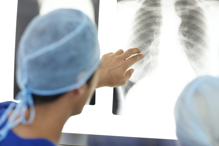 Why Is Rib Removal Surgery so Controversial? | RealSelf News