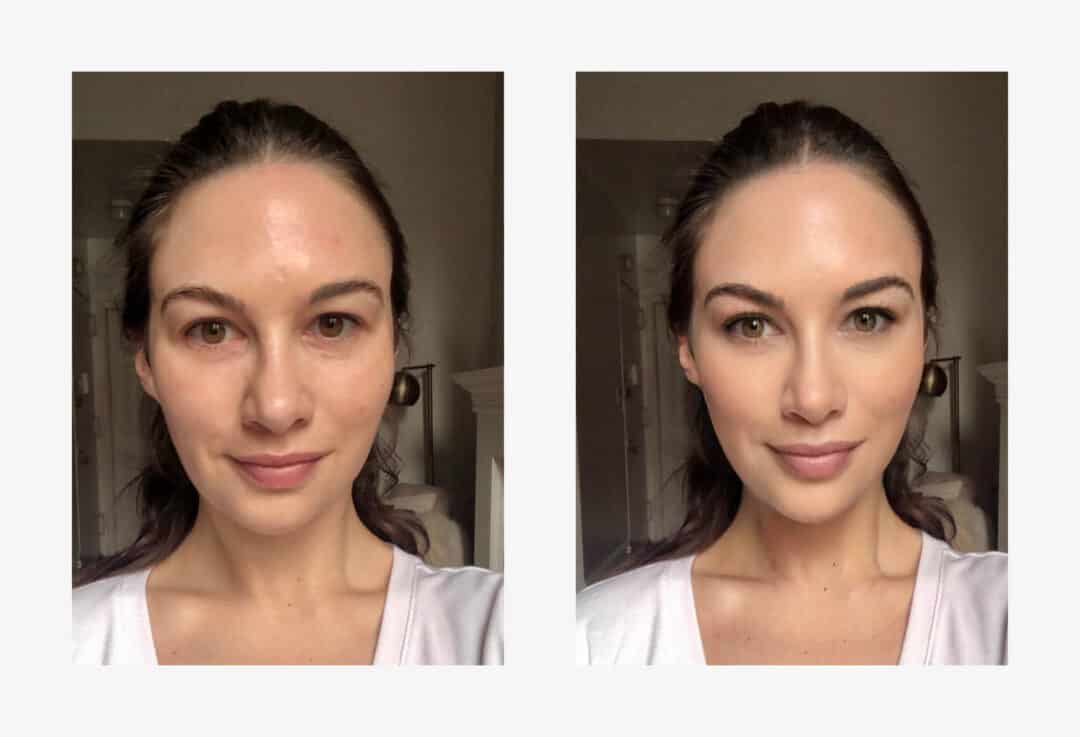 How 5 Photo Filters Perform Digital Surgery On Your Face | RealSelf News