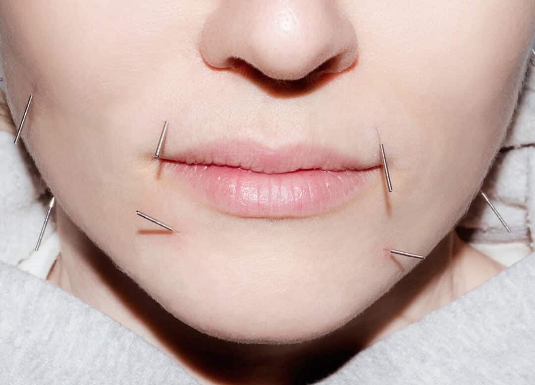 Which At-Home Botox Alternatives Actually Work | RealSelf News