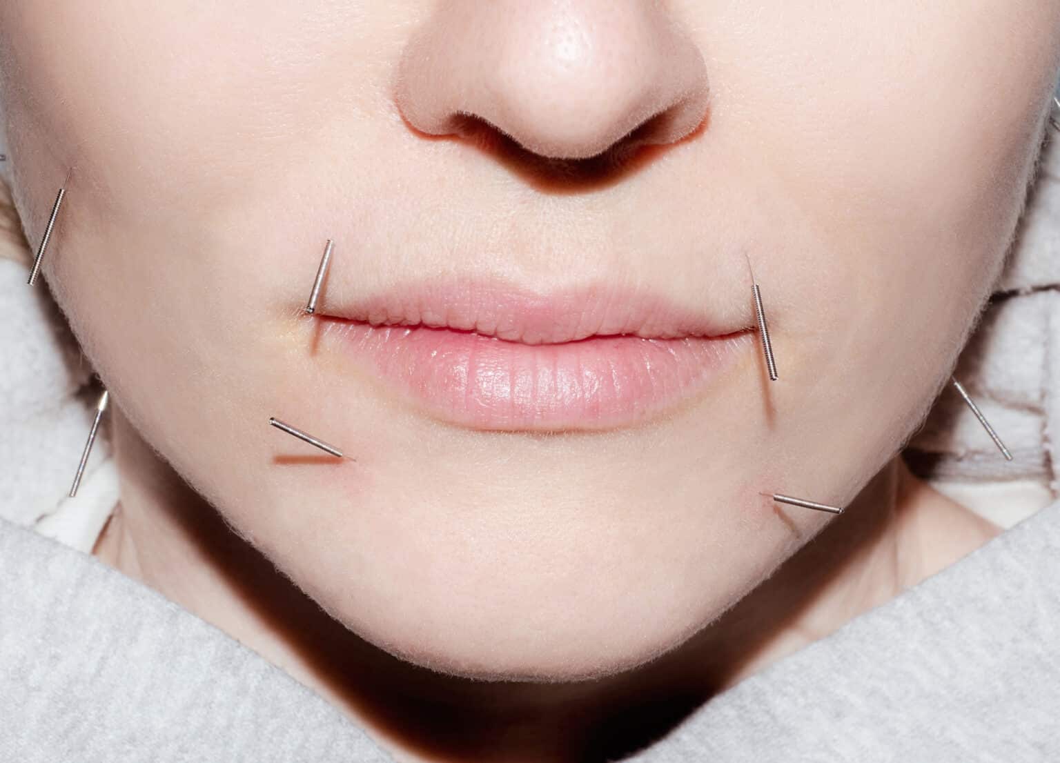 Which At-Home Botox Alternatives Actually Work | RealSelf News