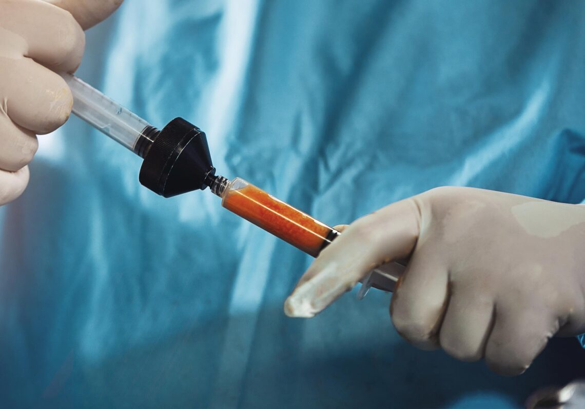 7 Fat Transfer Recovery Tips for the Best Results | RealSelf News