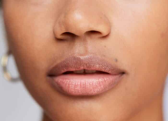 5 Signs of a Stellar Lip Lift, According to Plastic Surgeons | RealSelf ...