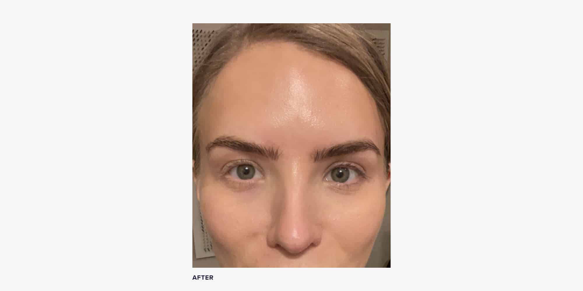 How My Eyebrows Look Before And After Microblading Realself News