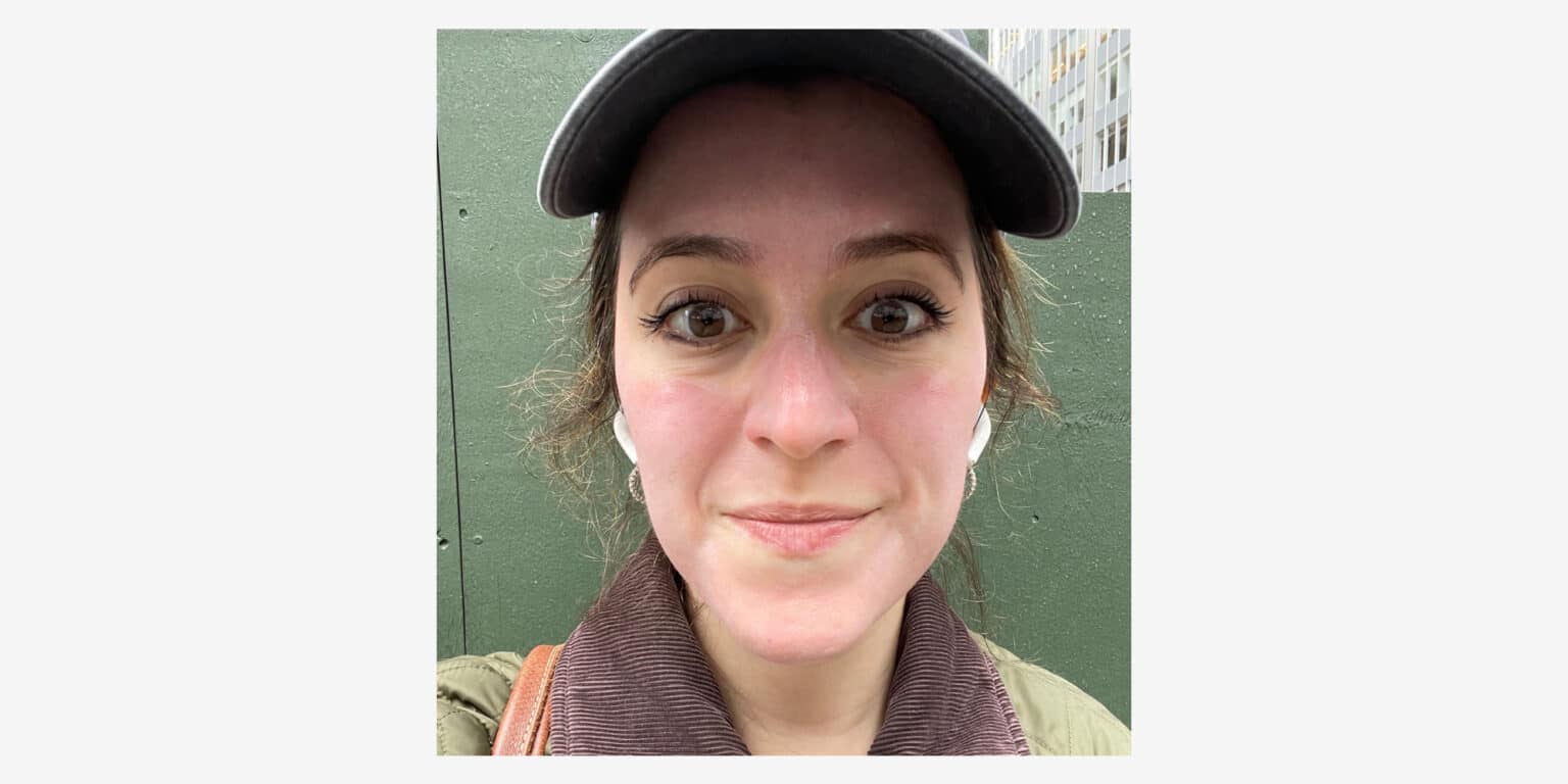 Cellstory Liquid Microneedling Treatment | RealSelf News