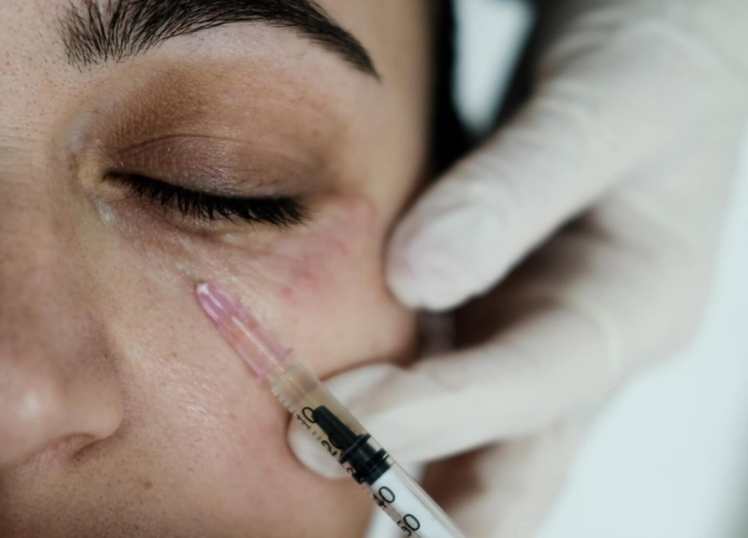 Which Under-Eye Filler Is Right for You? | RealSelf News