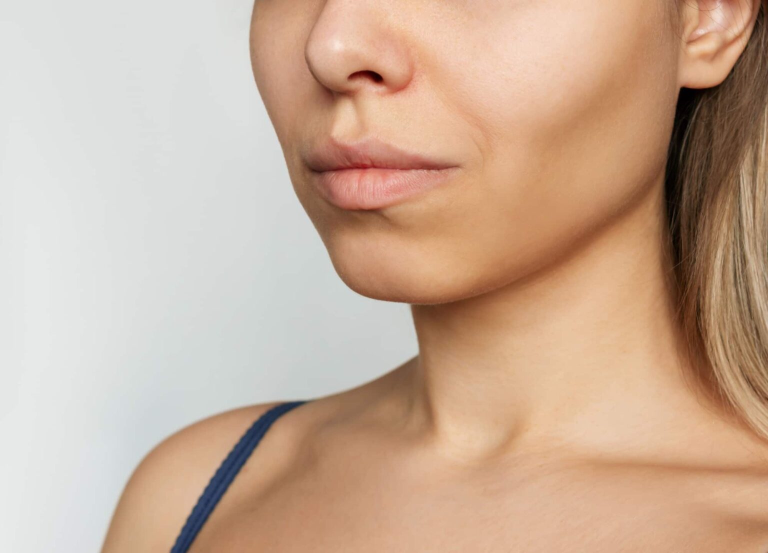 6 Best Sculptra Before and After Photos | RealSelf News