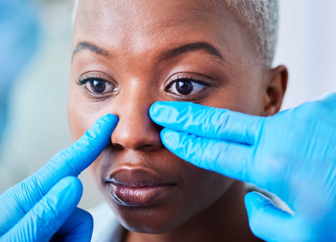 Everything You Need to Know About Nose Thread Lifts | RealSelf News