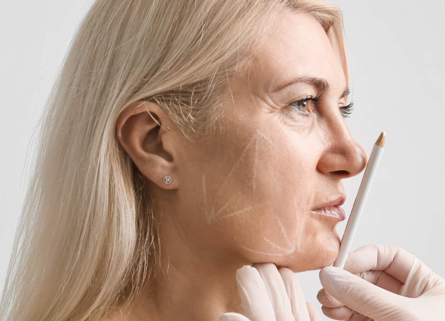 Facelift: Are You a Good Candidate? | RealSelf News