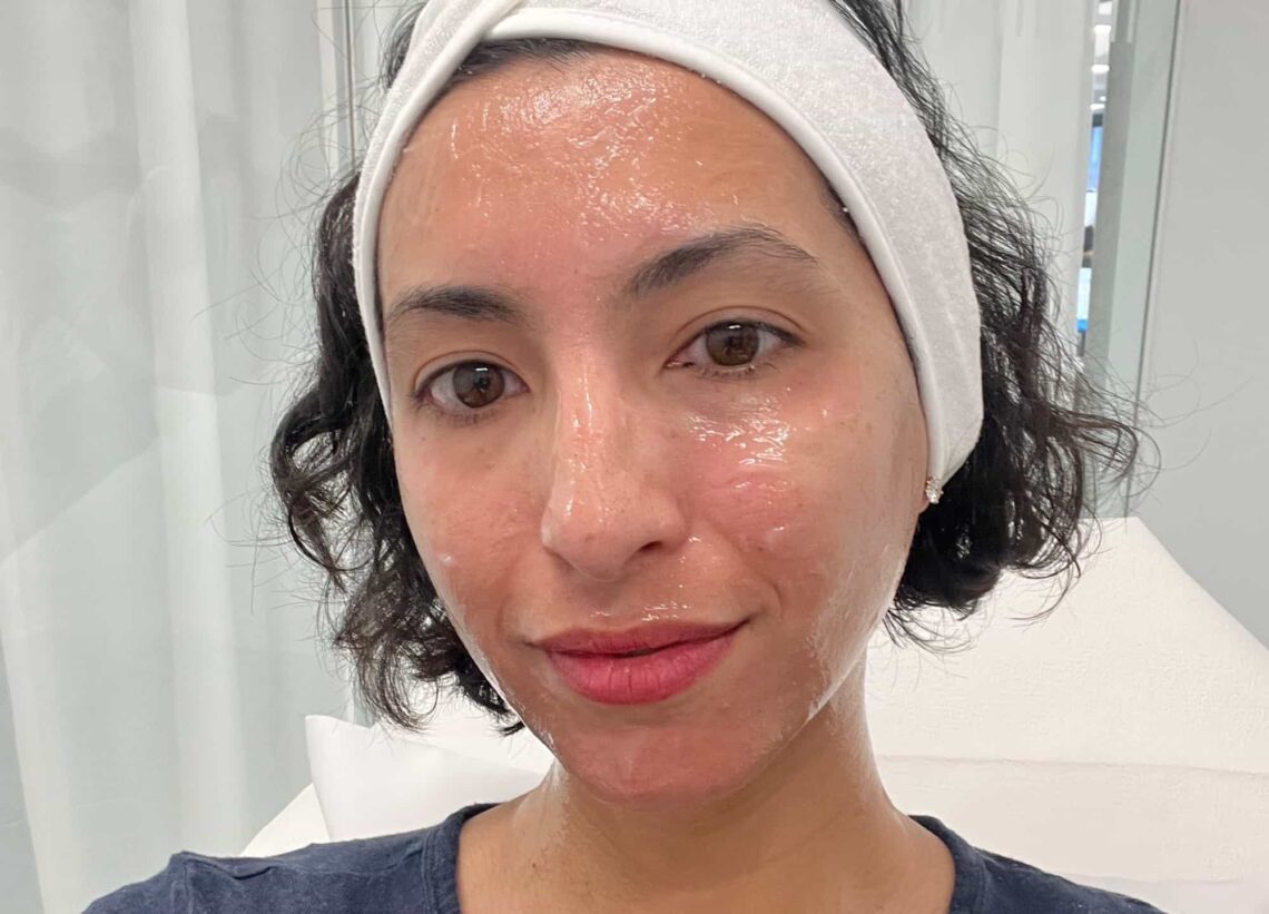 Hypopigmentation: What Causes It and How Is It Treated? | RealSelf News