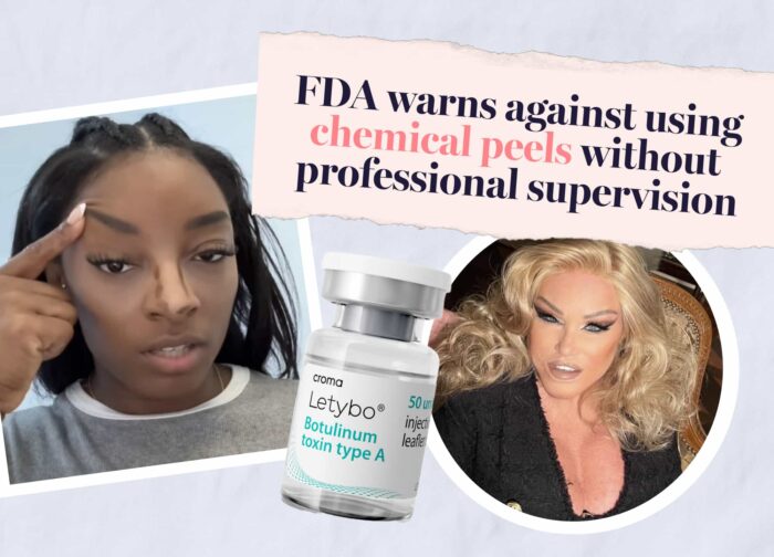 Simone Biles Botox, Christina Applegate Eyelid Surgery | RealSelf News