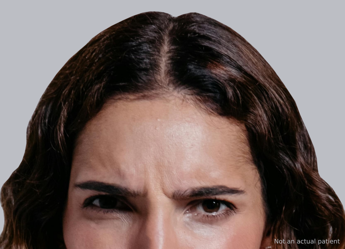 My Skinvive Before-and-After Results | RealSelf News